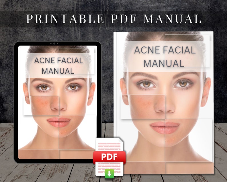 Acne Facial Treatments Printable PDF Course Training Manual User Guide ...