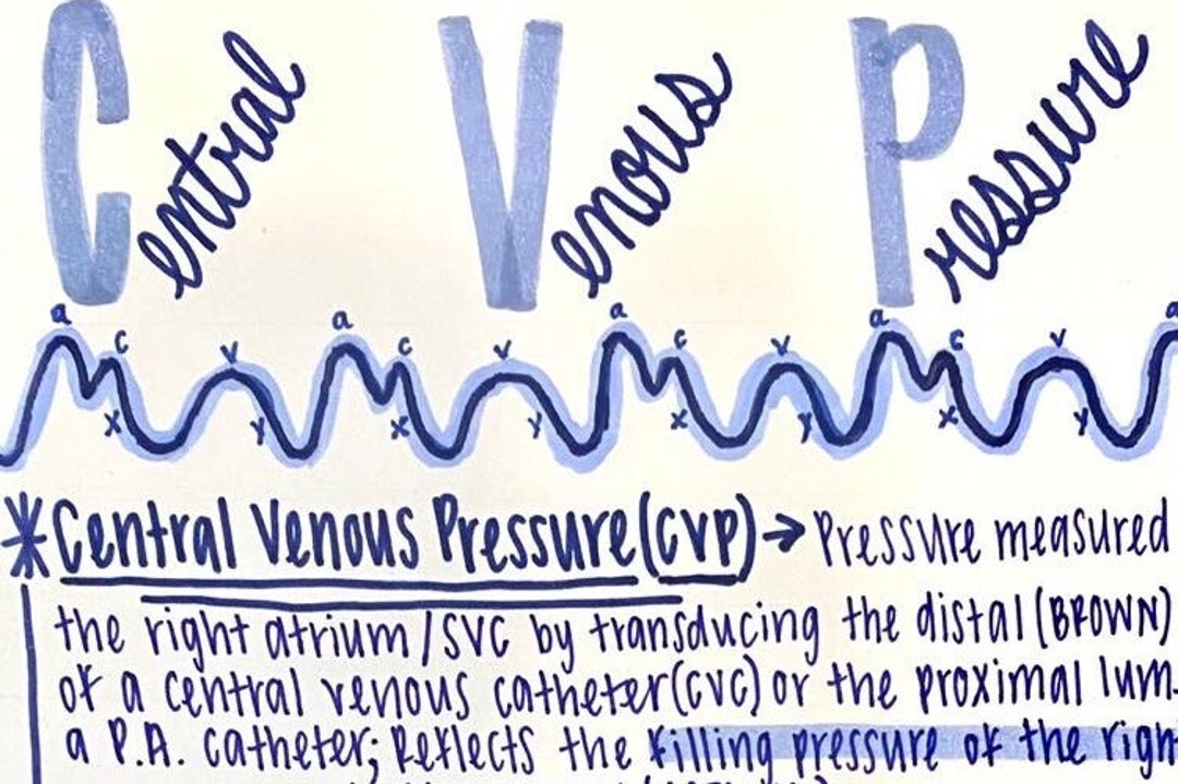 Central Venous Pressure CVP for Nurses - Etsy
