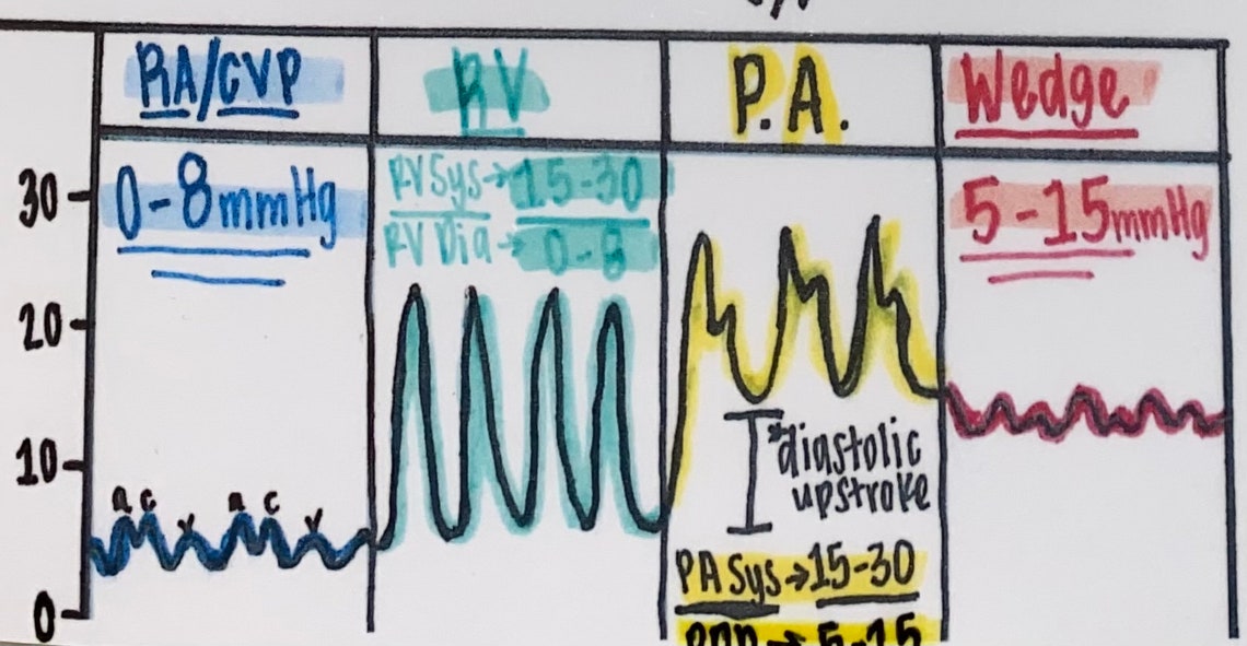 PA Catheter Ports & Waveforms ICU Nursing Concept Map | Etsy