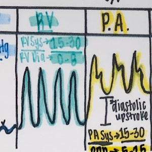 PA Catheter Ports & Waveforms ICU Nursing Concept Map - Etsy