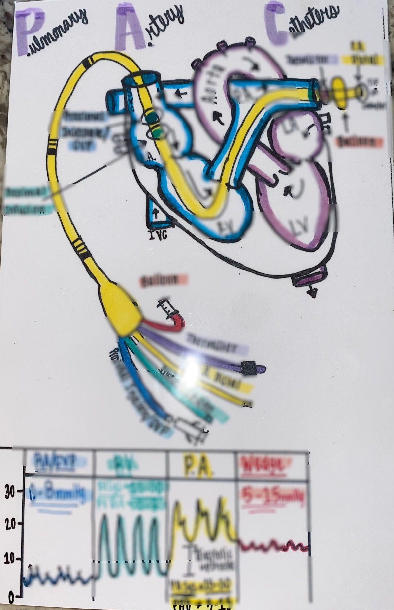 PA Catheter Ports & Waveforms ICU Nursing Concept Map | Etsy