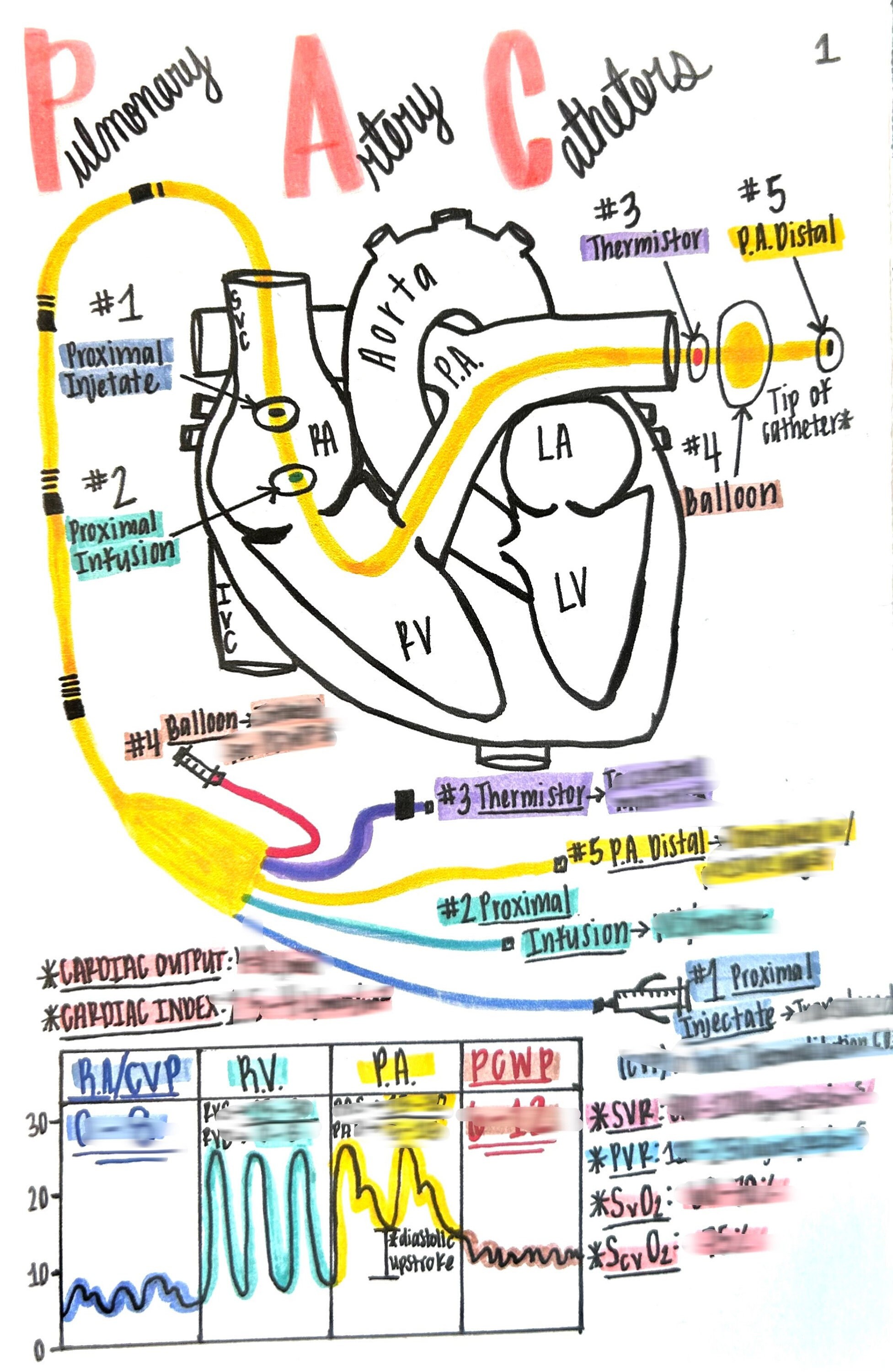 PA Catheter DIGITAL DOWNLOAD - Etsy