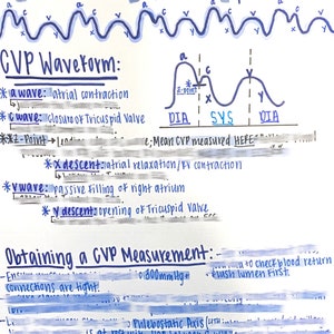 CVP Waveforms DIGITAL DOWNLOAD - Etsy