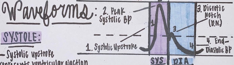 Arterial Line ICU Nurse Reference Sheet - Etsy