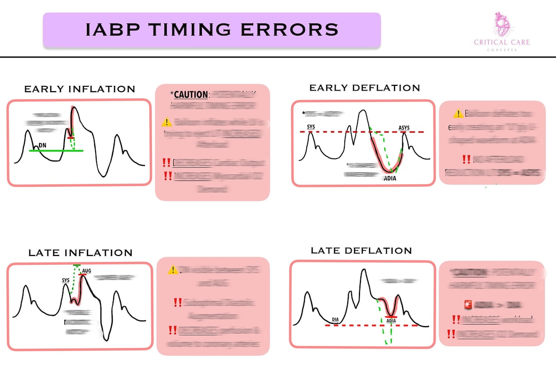 IABP Waveform & Timing Errors ICU Nurse Reference Sheet - Etsy