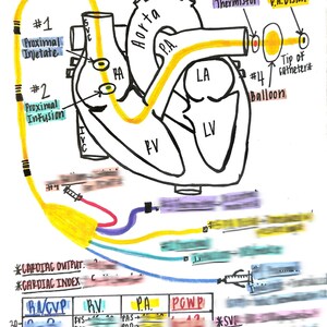 Hemodynamics/invasive Lines ICU BUNDLE DEAL Digital Download - Etsy