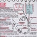Arterial Line ICU Nurse Reference Sheet - Etsy