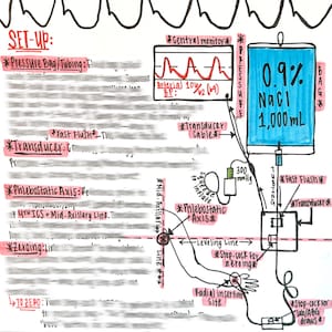 Arterial Line DIGITAL DOWNLOAD ICU Nurse Reference (Download Now) - Etsy