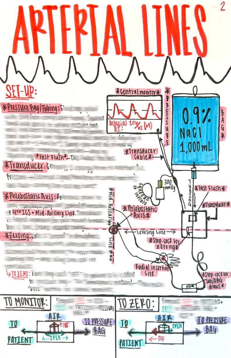 Arterial Line DIGITAL DOWNLOAD ICU Nurse Reference (Download Now) - Etsy