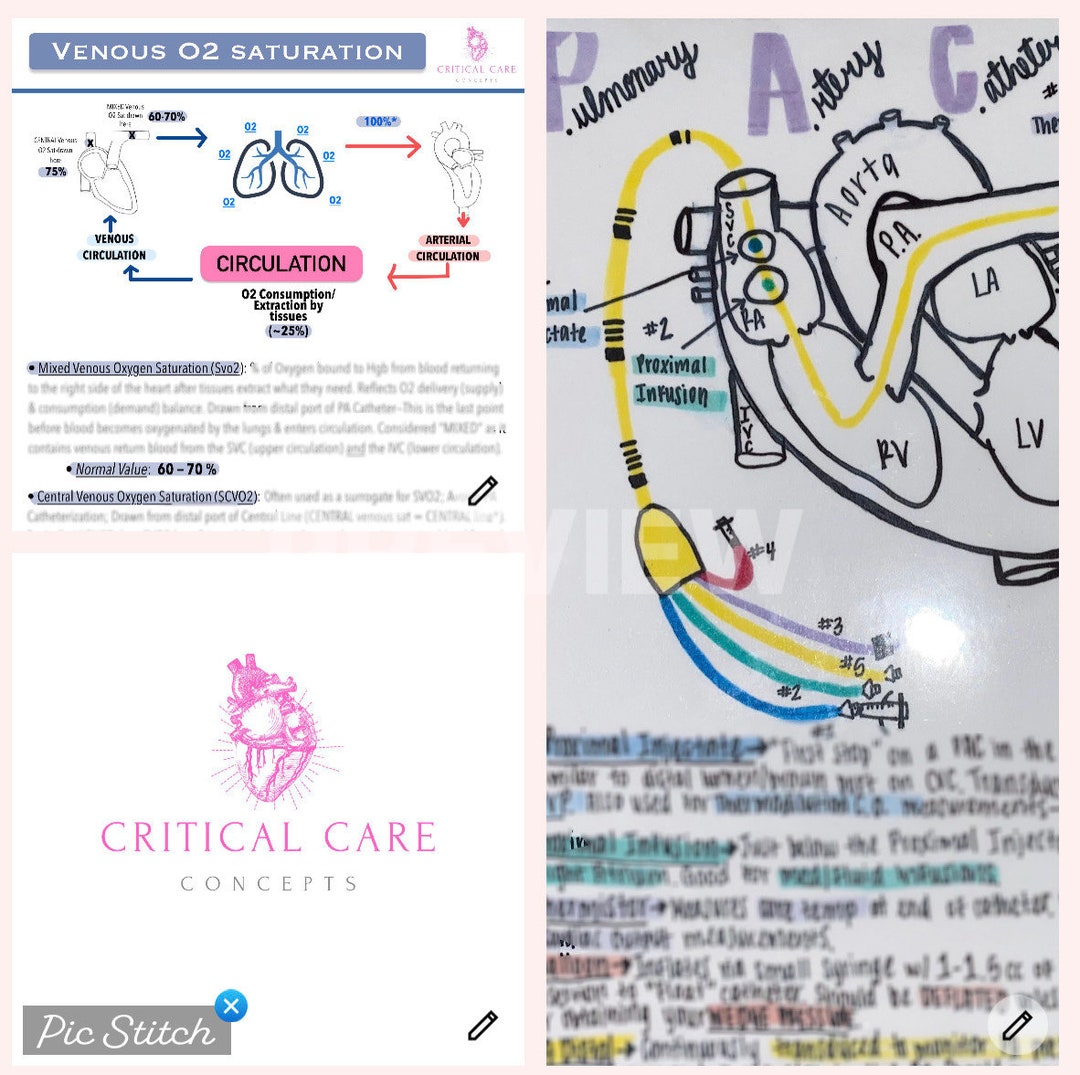 PA Catheter/venous O2 Sat BUNDLE - Etsy