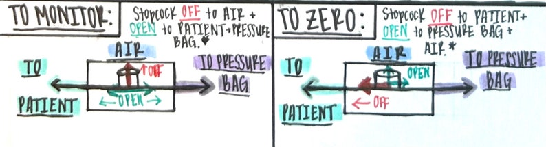 Arterial Line DIGITAL DOWNLOAD ICU Nurse Reference (Download Now) - Etsy