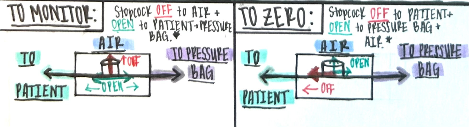 Arterial Line DIGITAL DOWNLOAD ICU Nurse Reference (Download Now) - Etsy