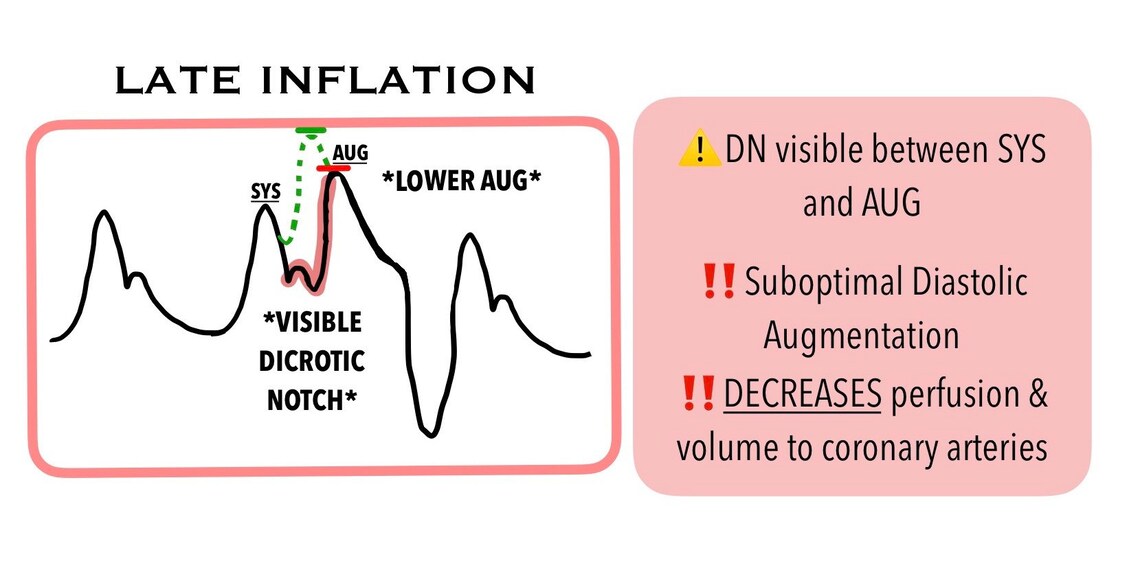 IABP Waveform & Timing Errors ICU Nurse Reference Sheet - Etsy