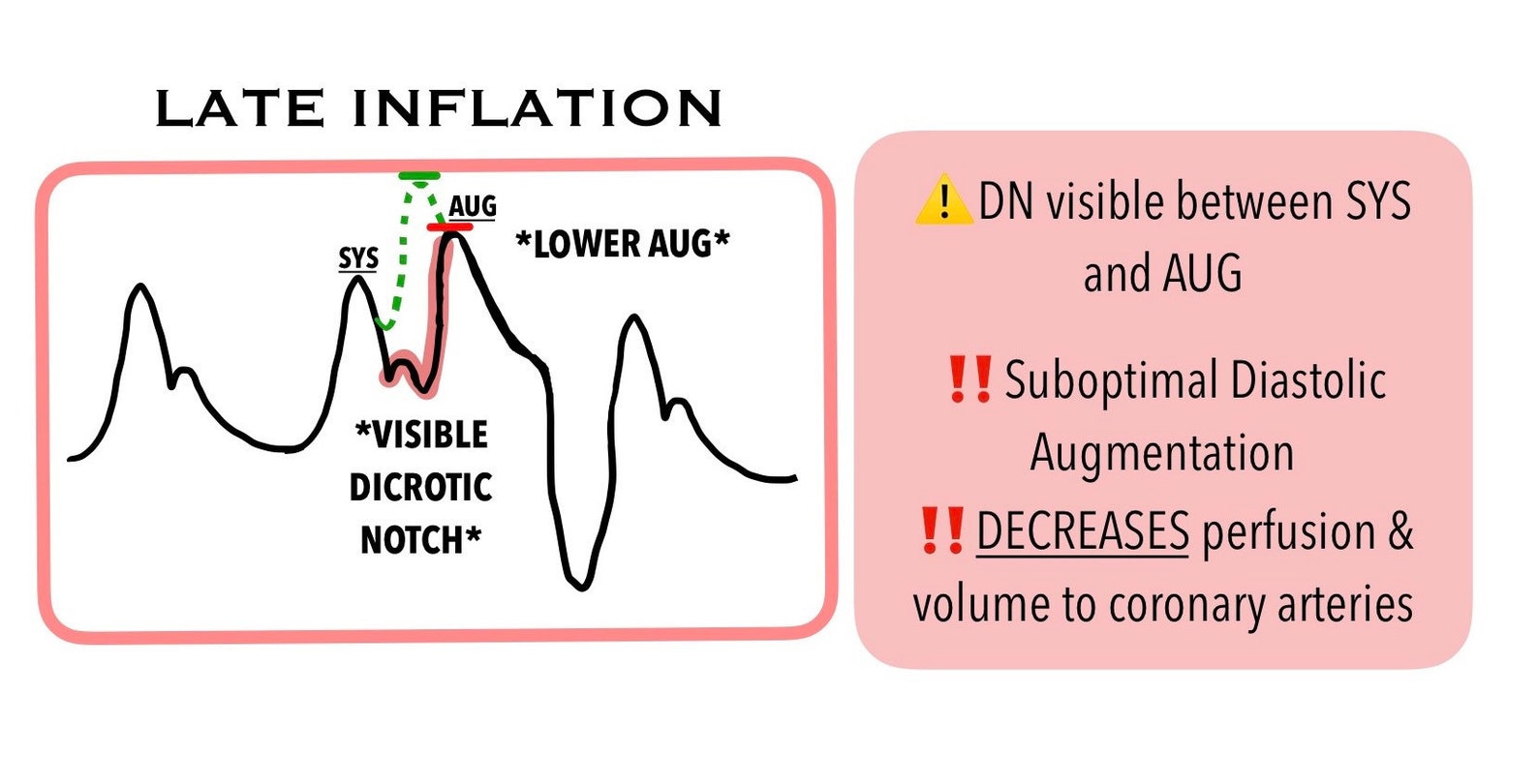 IABP Waveform & Timing Errors ICU Nurse Reference Sheet - Etsy