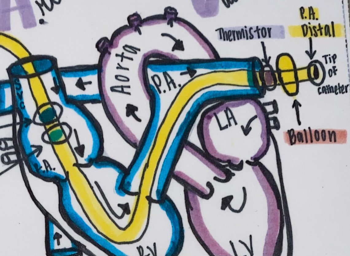PA Catheter Ports & Waveforms ICU Nursing Concept Map | Etsy