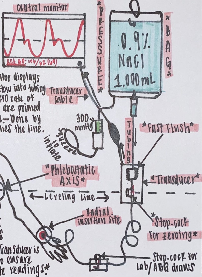 Arterial Line ICU Nurse Reference Sheet - Etsy