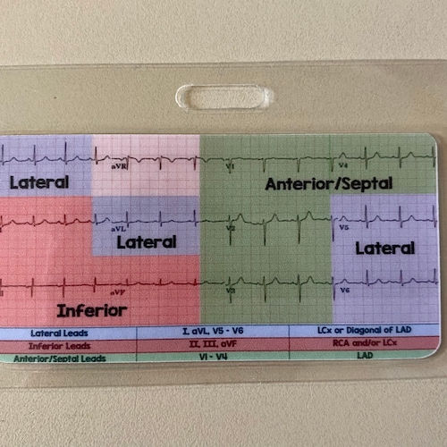 EKG 12 Lead Placement Horizontal Badge Card - Etsy