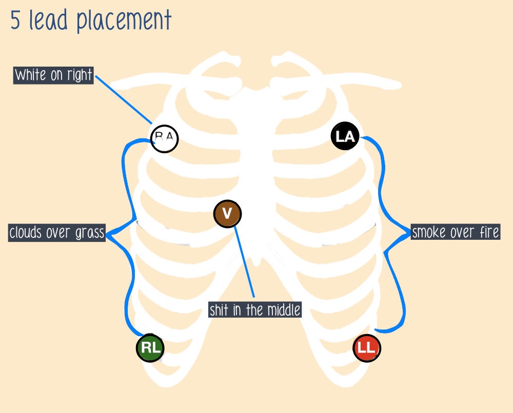 5 Lead Placement With Helpful Tips - Etsy