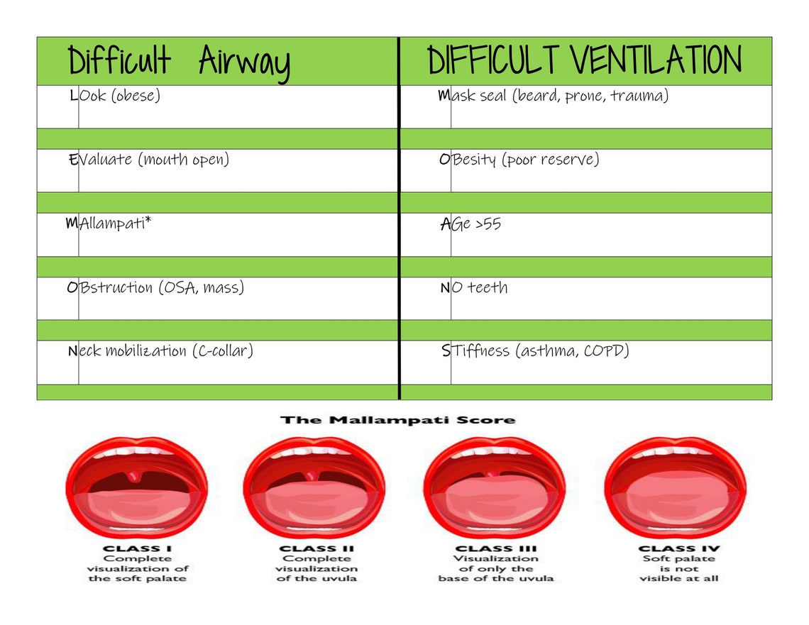 Intubation Cheat Sheets - Etsy