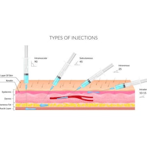 Different Types of Injections - Etsy