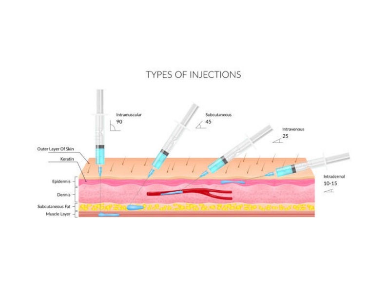 Different Types of Injections - Etsy