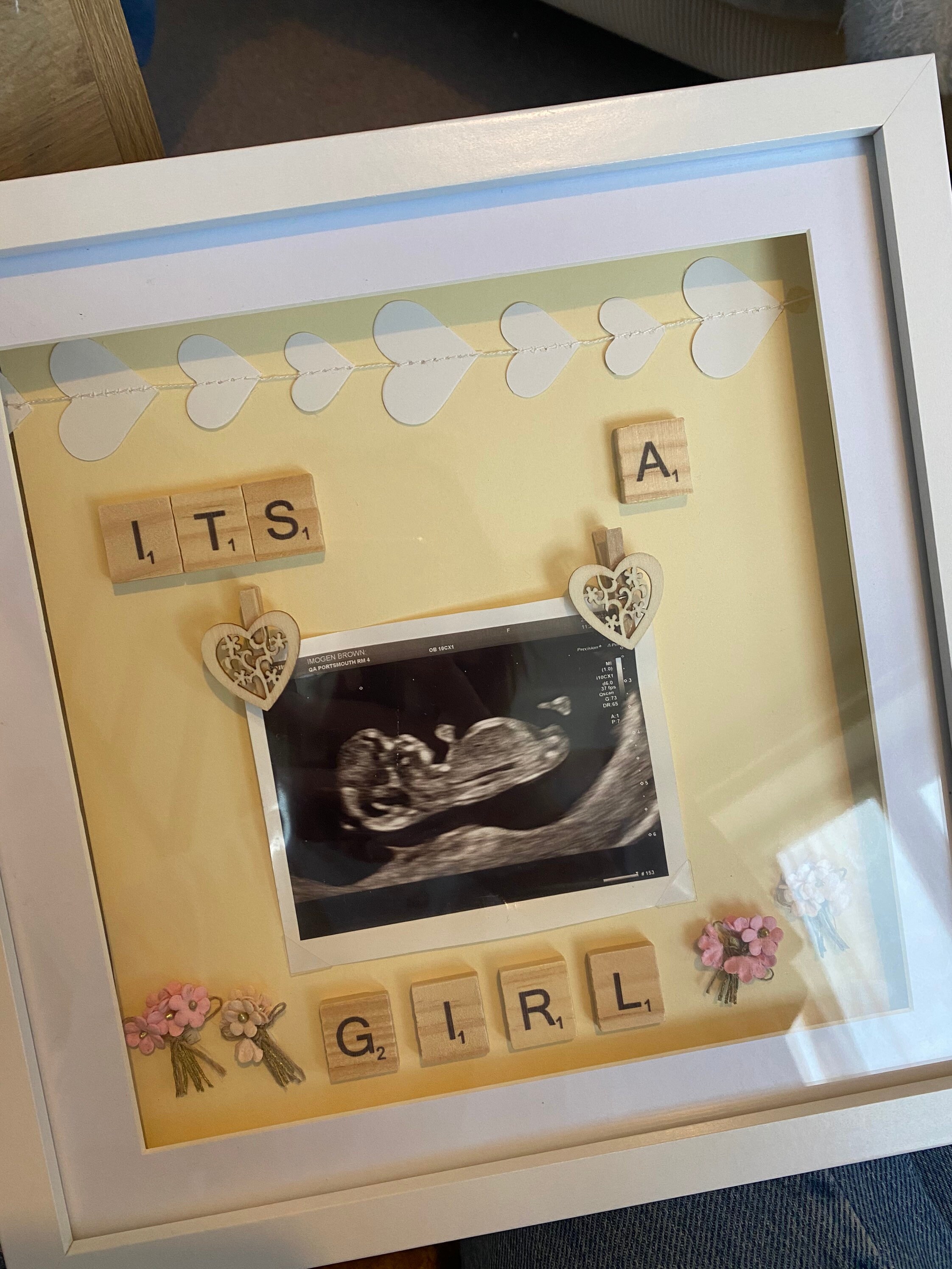 Girl Gender Reveal Scan Frame - Etsy