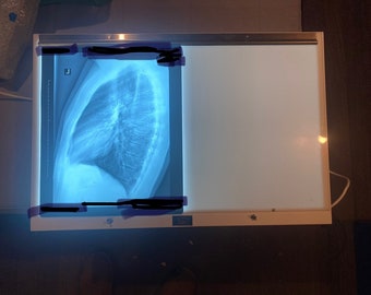 X Ray Light Box - Etsy