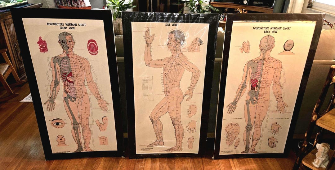 Vintage Acupuncture Meridian Charts Set of 3 | Anatomical Medical Wall ...