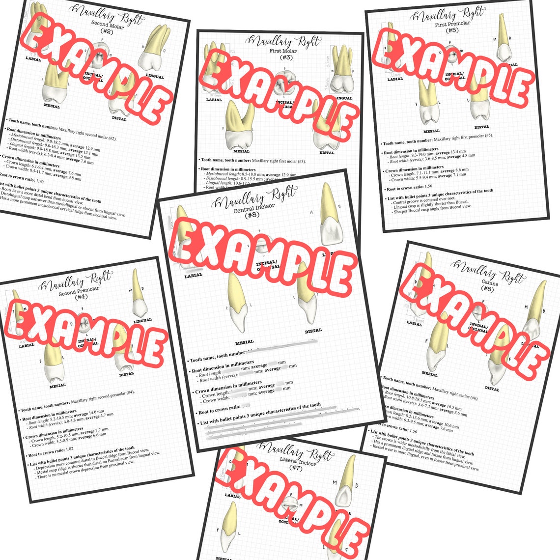 Tooth Drawing Project- Dental Anatomy Quad 1 - Etsy