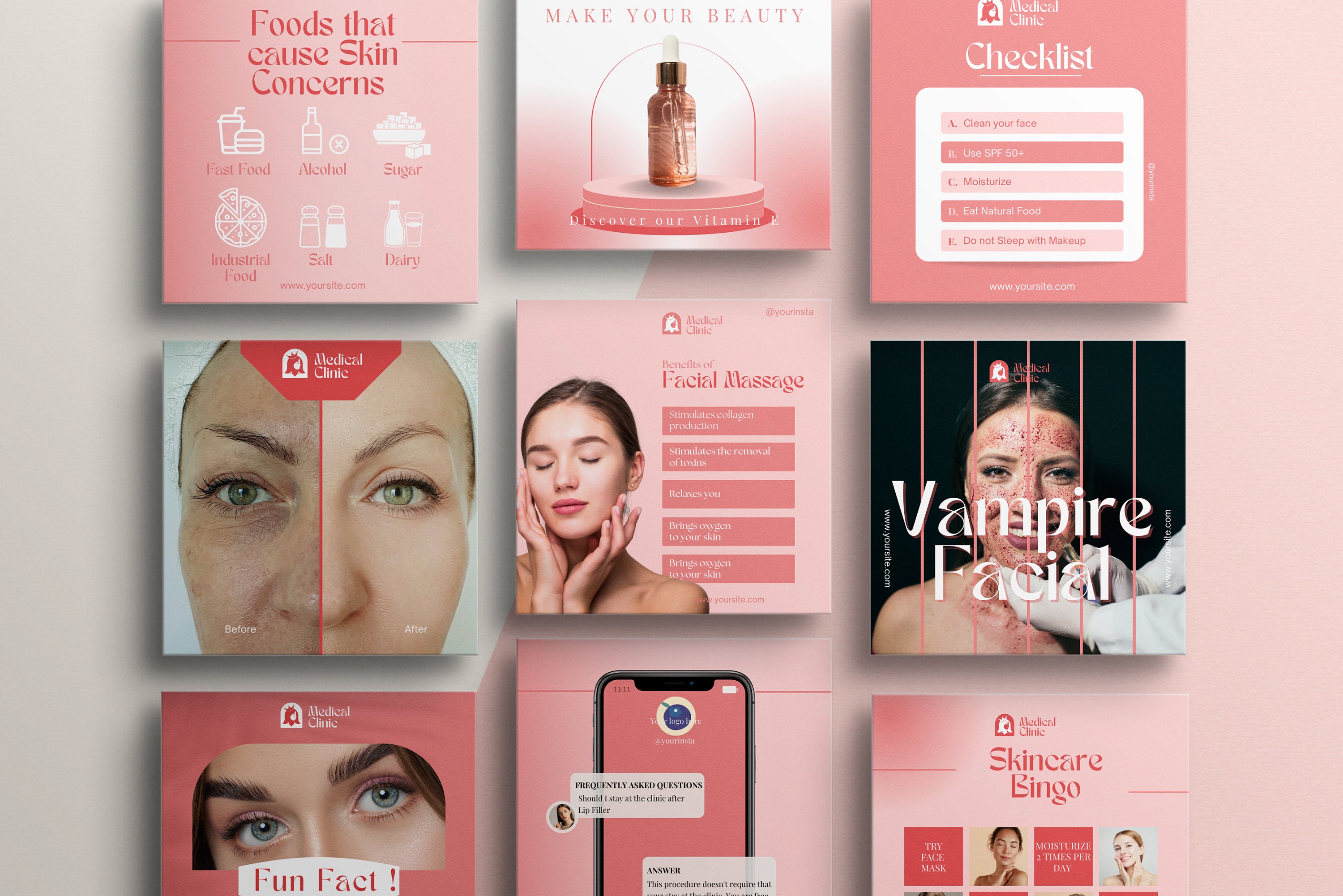 Plastic Surgery Instagram Template, Cosmetic Procedure Lip Fillers and ...