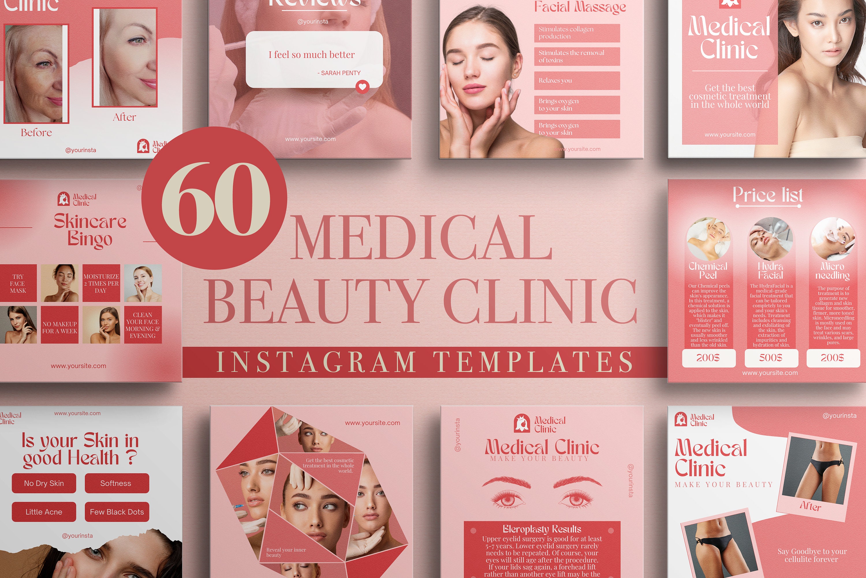 Plastic Surgery Instagram Template, Cosmetic Procedure Lip Fillers and ...