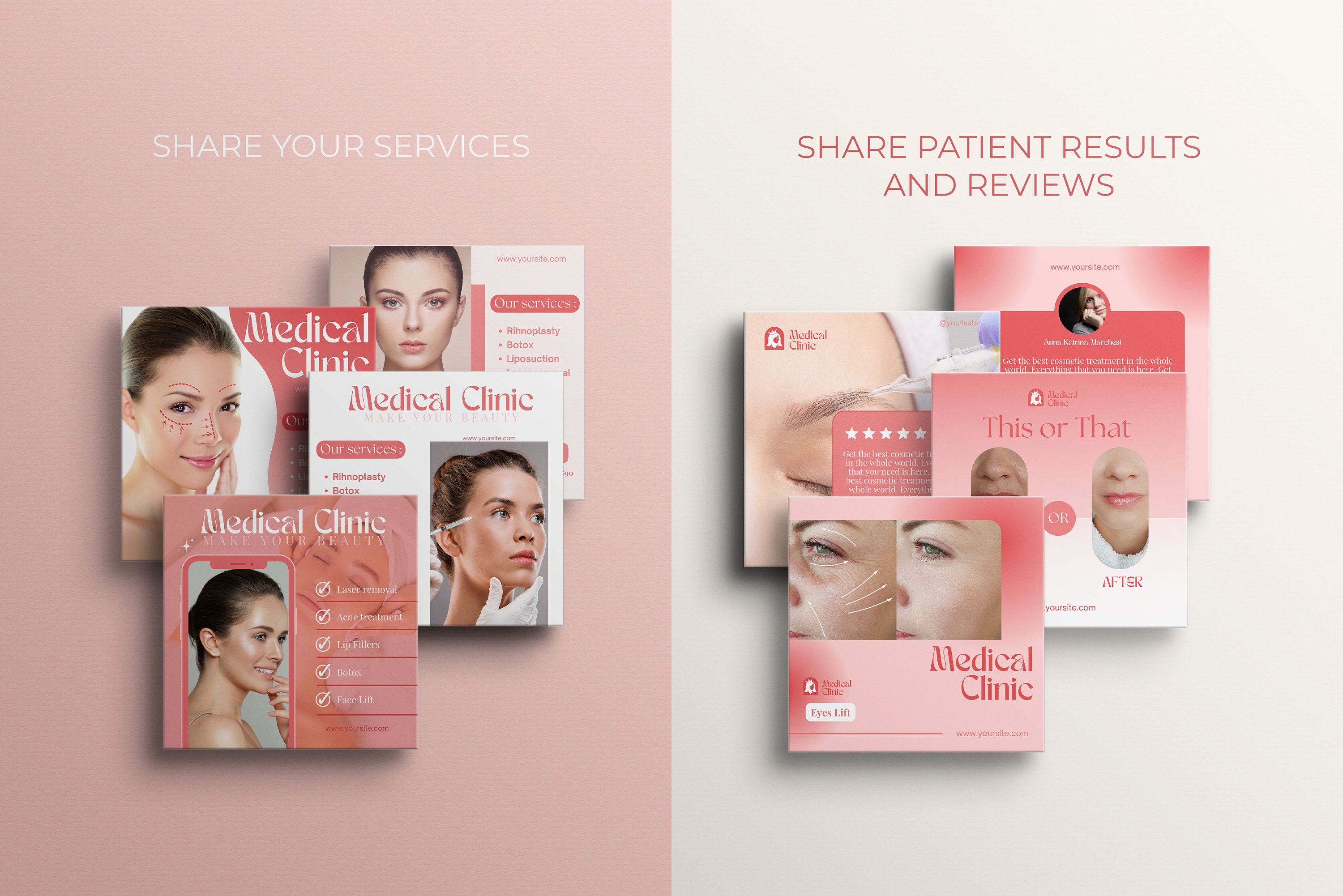 Plastic Surgery Instagram Template, Cosmetic Procedure Lip Fillers and ...