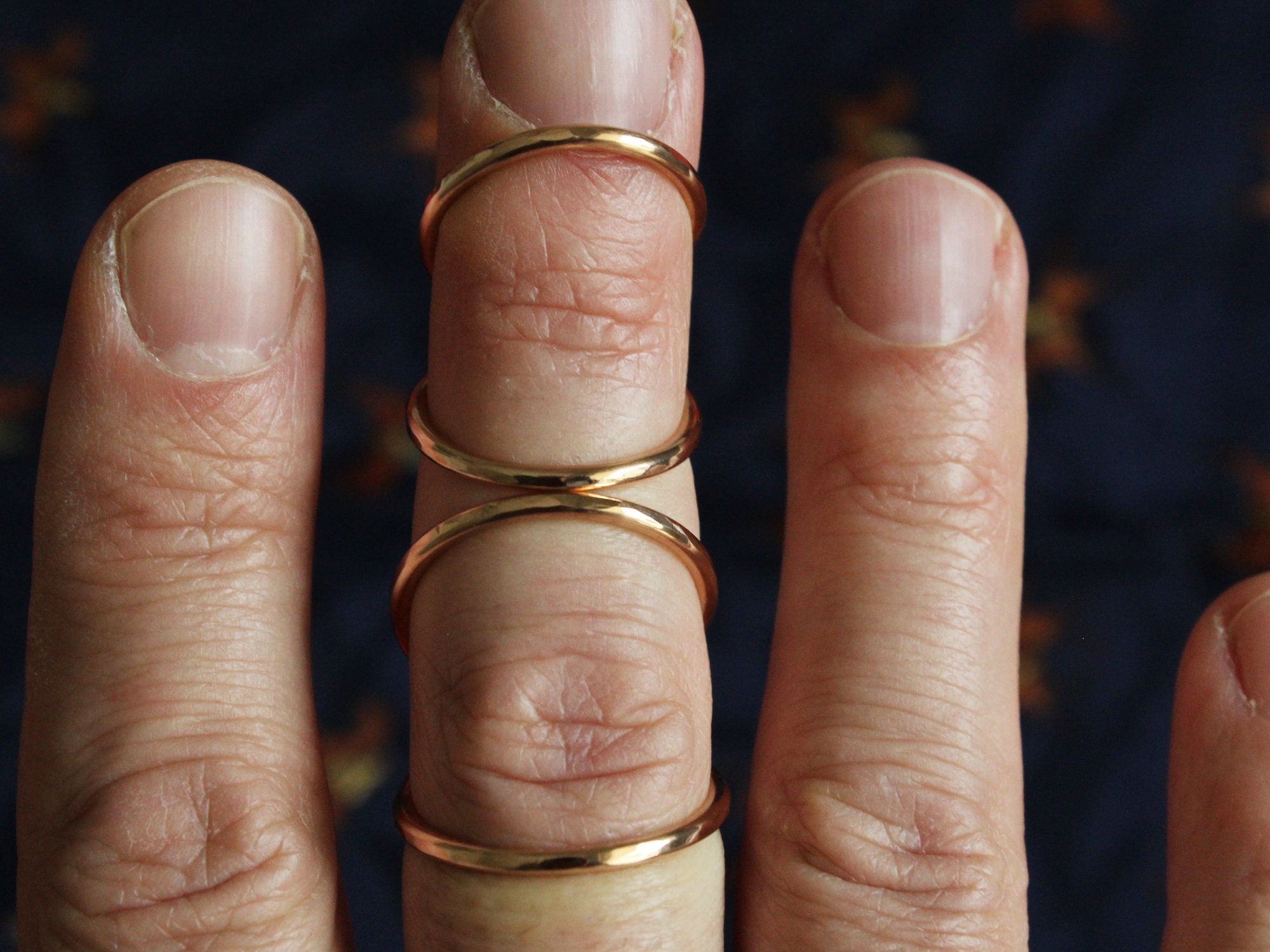 Set of Two Hyperextension Rings, Arthritis Finger Splint in Bronze, 2 ...