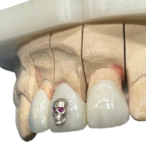 Teeth Gems 18 K Skull With Rubies 3-D - Etsy
