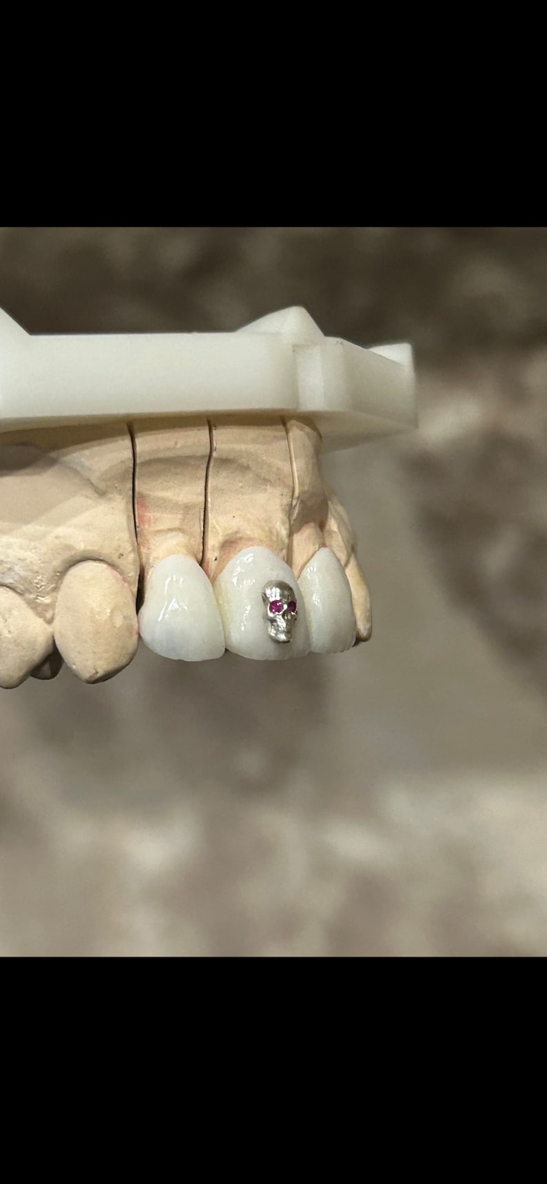 Teeth Gems 18 K Skull With Rubies 3-D - Etsy