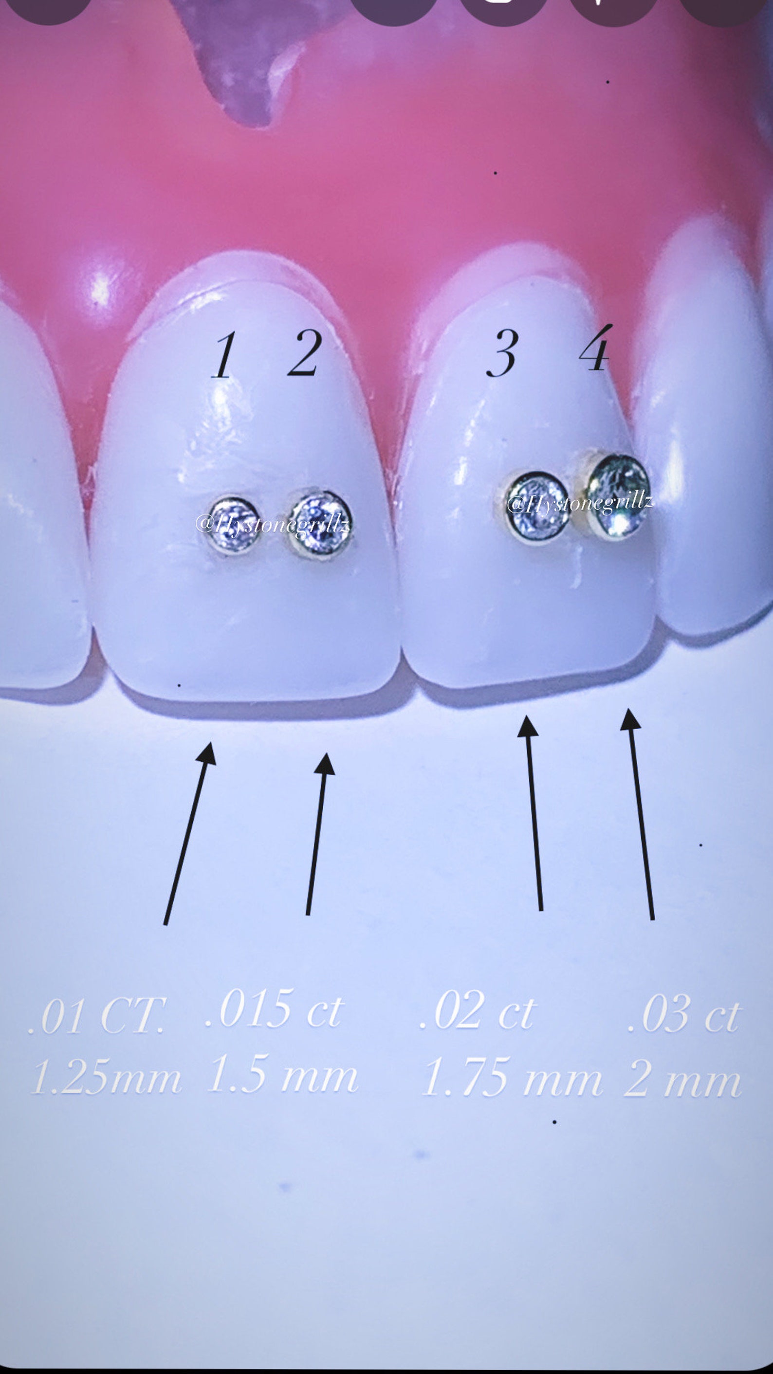 18k Diamond Bezel Gold Tooth Gem Vs Diamond Tooth Gem Tooth Charm Teeth ...