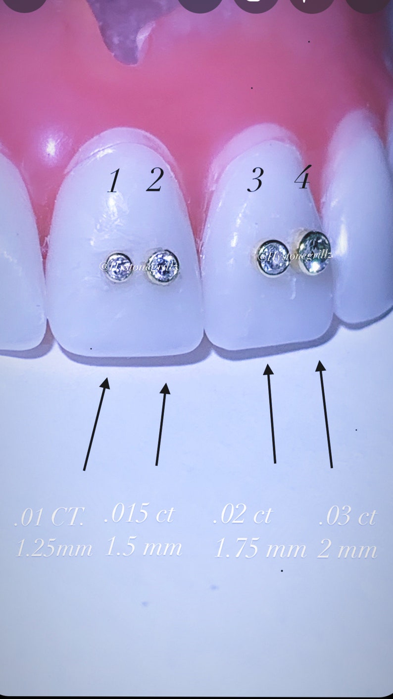 Tooth Gems 18k Diamond Bezel - Etsy