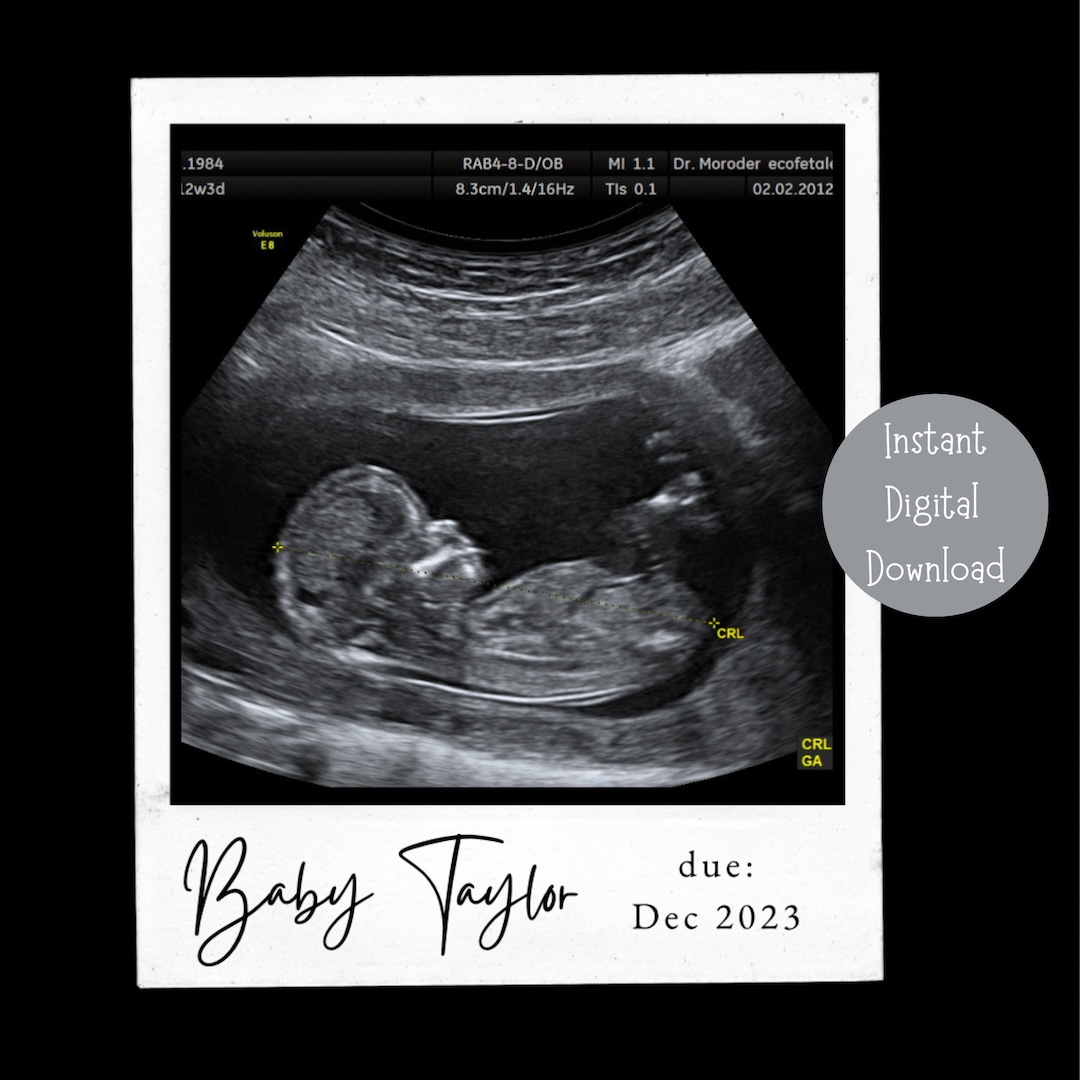 Instagram Pregnancy Announcement | Baby Announcement | Editable ...