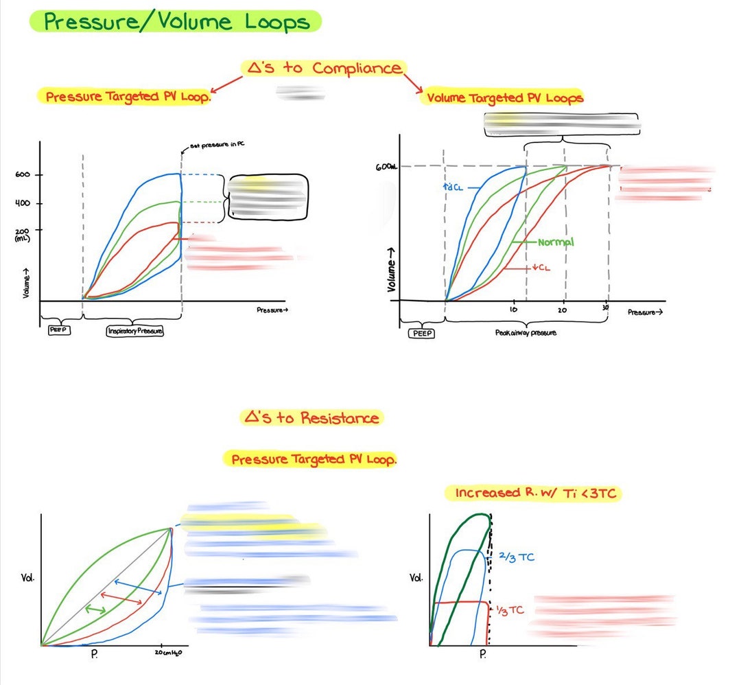 Mechanical Ventilation - Etsy