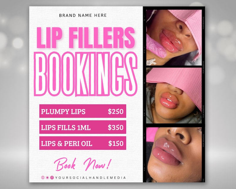 Lip Fillers Flyer, Botox Fillers Instagram Post, Digital Templates Lip ...