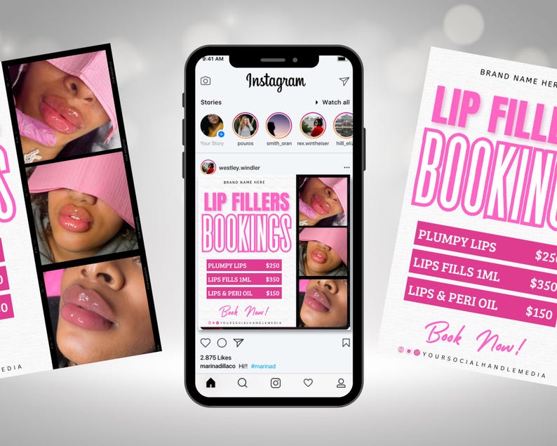 Lip Fillers Flyer, Botox Fillers Instagram Post, Digital Templates Lip ...