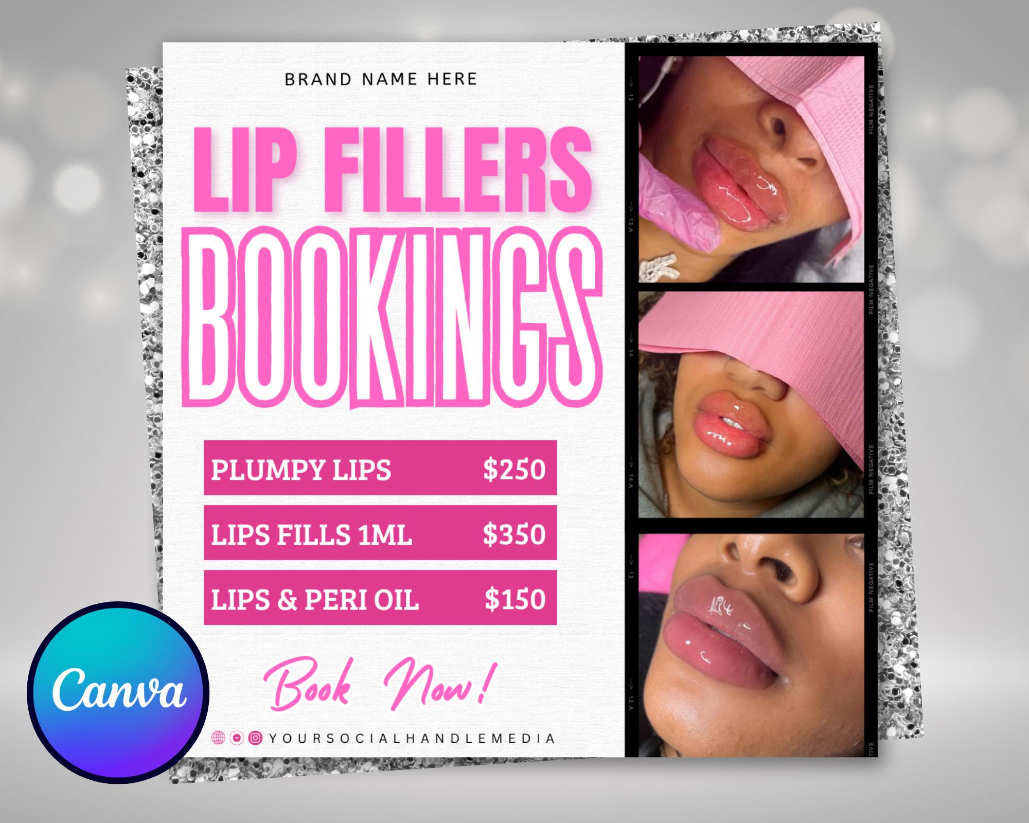 Lip Fillers Flyer, Botox Fillers Instagram Post, Digital Templates Lip ...