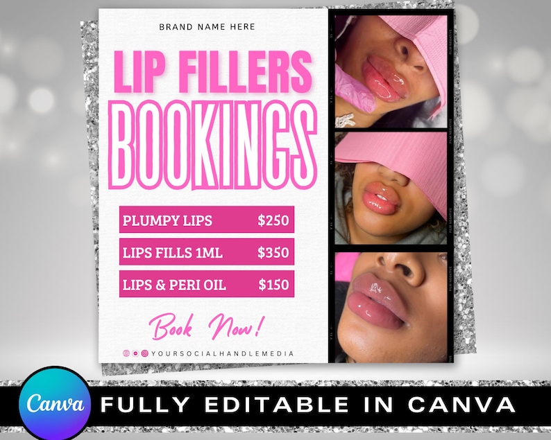 Lip Fillers Flyer, Botox Fillers Instagram Post, Digital Templates Lip ...