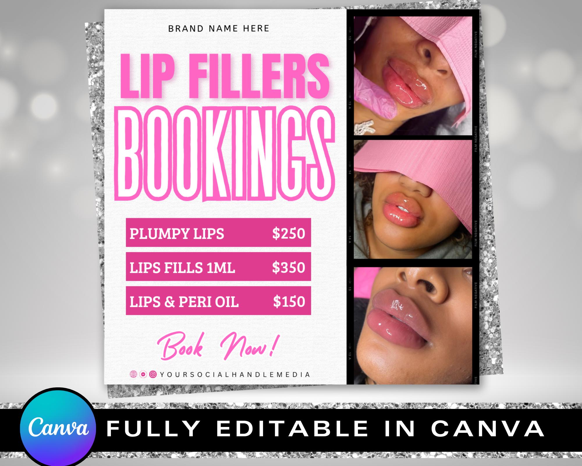 Lip Fillers Flyer, Botox Fillers Instagram Post, Digital Templates Lip ...