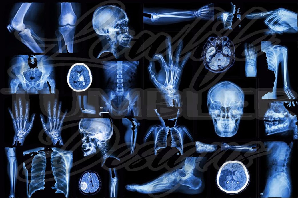 Xray Seamless Pattern Skull Fabric Skull Clipart Skull Svg - Etsy