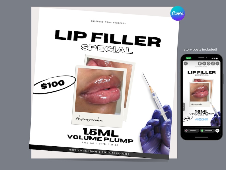 Lip Filler Special Flyer, Flyer for Lip Fillers, Esthetician Flyer ...
