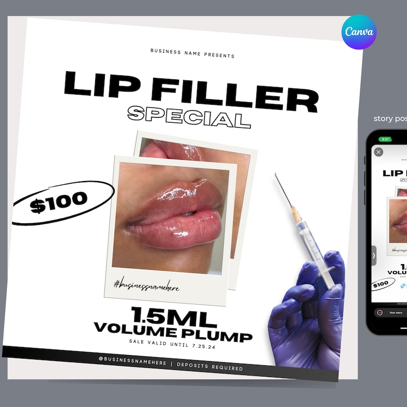 Pen Lip Filler Template - Etsy