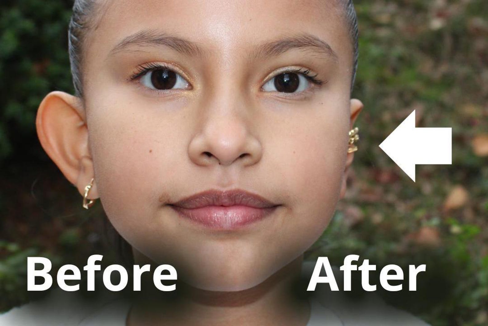 Earring for Protruding Ears, Earcuff Elegant, Ear Cuff - Etsy