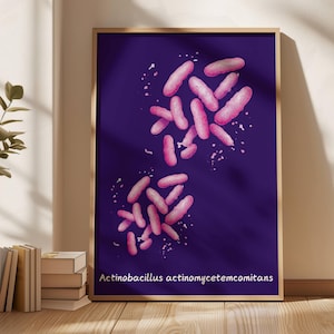 Dental Art Poster for Dental Office Decor Actinobacillus ...