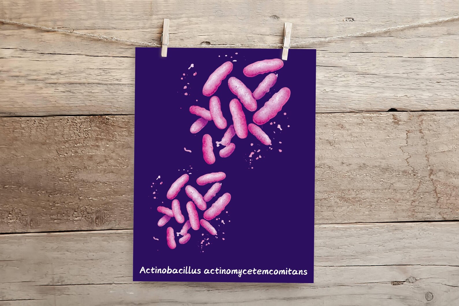 Dental Art Poster for Dental Office Decor Actinobacillus ...
